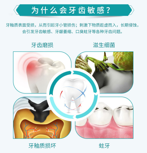 美加净牙膏_maxam 美加净 上海防酸抗敏牙膏 90g多少钱-什么值得买